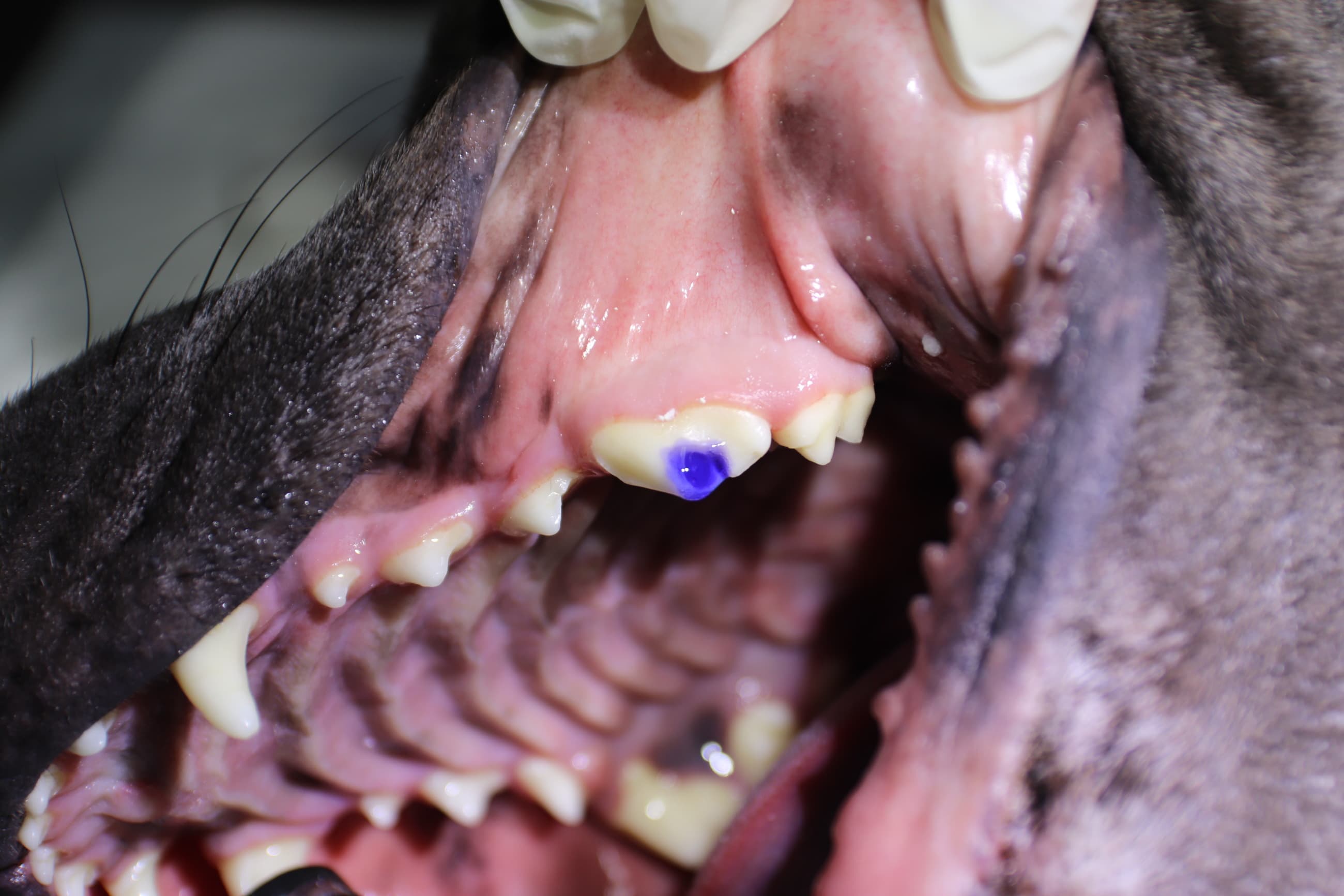 Treatment of tooth fracture | Hanima